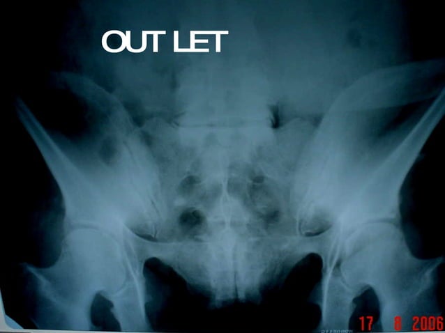 rx Pelvis.proyec.no convencionales-Lic.Juan Jose MOntico -Argentina ...