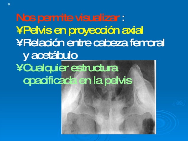 rx Pelvis.proyec.no convencionales-Lic.Juan Jose MOntico -Argentina ...
