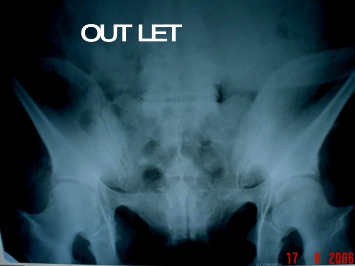 rx Pelvis.proyec.no convencionales-Lic.Juan Jose MOntico -Argentina.C…