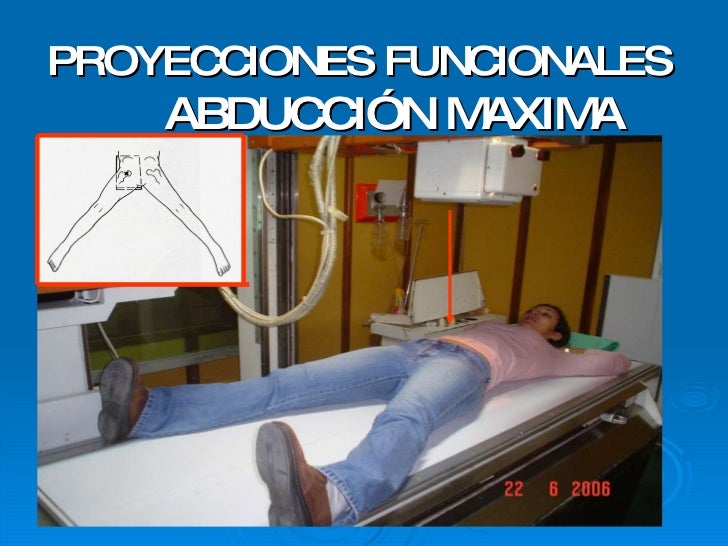 rx Pelvis.proyec.no convencionales-Lic.Juan Jose MOntico -Argentina.C…
