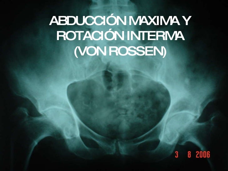 rx Pelvis.proyec.no convencionales-Lic.Juan Jose MOntico -Argentina.C…