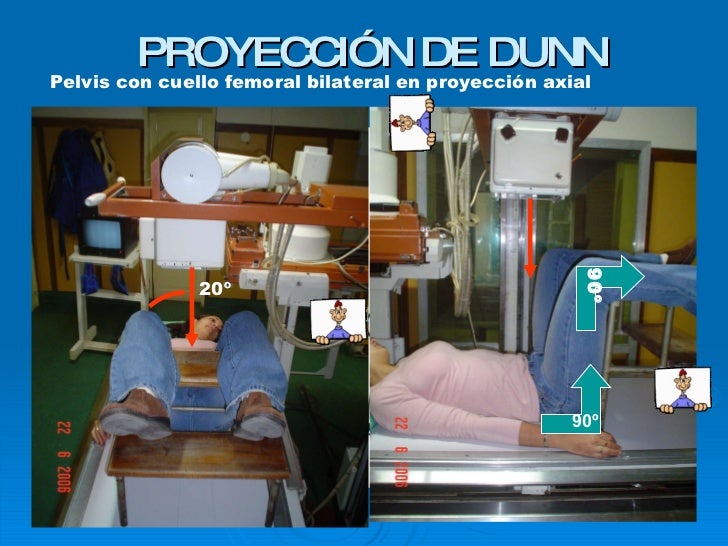 rx Pelvis.proyec.no convencionales-Lic.Juan Jose MOntico -Argentina.C…