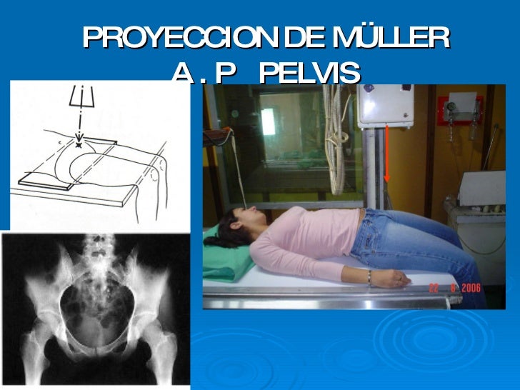 rx Pelvis.proyec.no convencionales-Lic.Juan Jose MOntico -Argentina.C…