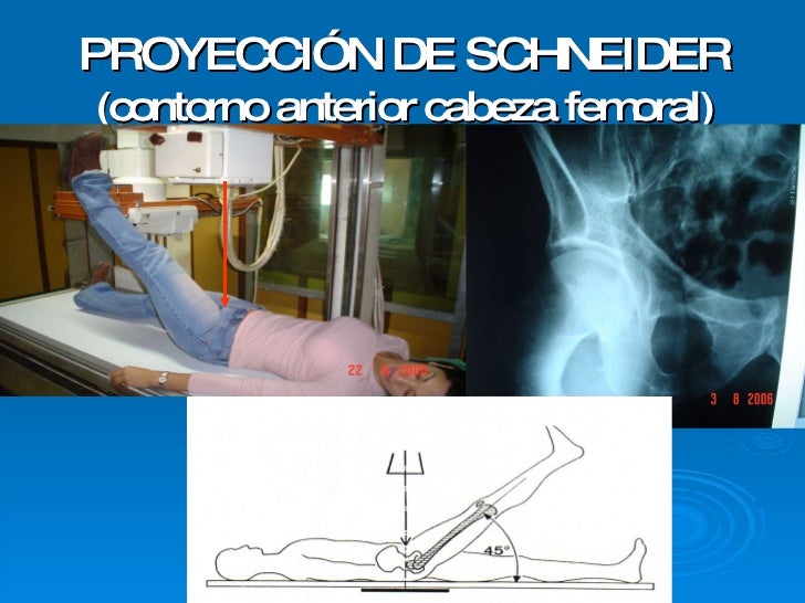 rx Pelvis.proyec.no convencionales-Lic.Juan Jose MOntico -Argentina.C…