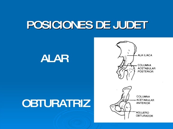 rx Pelvis.proyec.no convencionales-Lic.Juan Jose MOntico -Argentina.C…