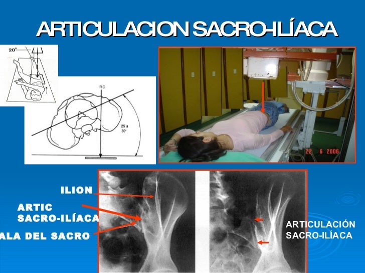 rx Pelvis.proyec.no convencionales-Lic.Juan Jose MOntico -Argentina.C…