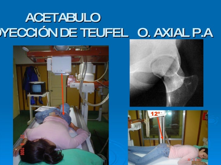 rx Pelvis.proyec.no convencionales-Lic.Juan Jose MOntico -Argentina.C…