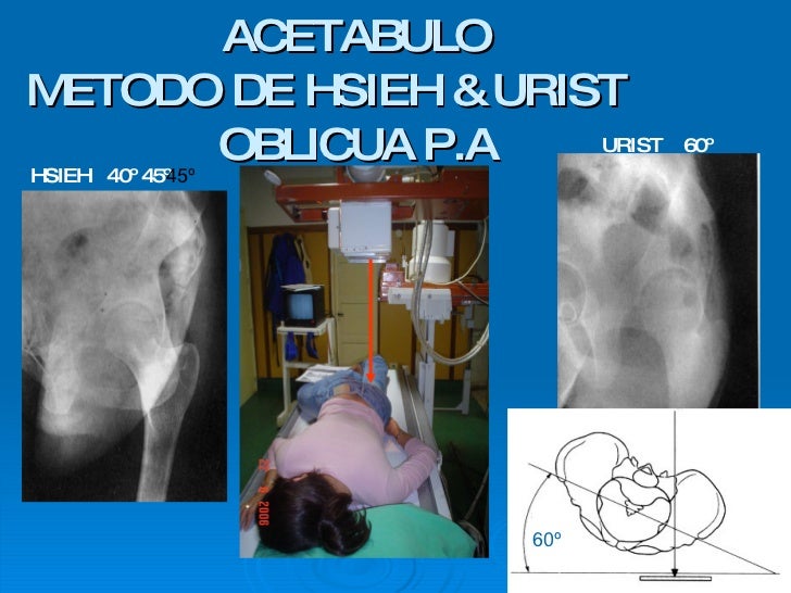 rx Pelvis.proyec.no convencionales-Lic.Juan Jose MOntico -Argentina.C…