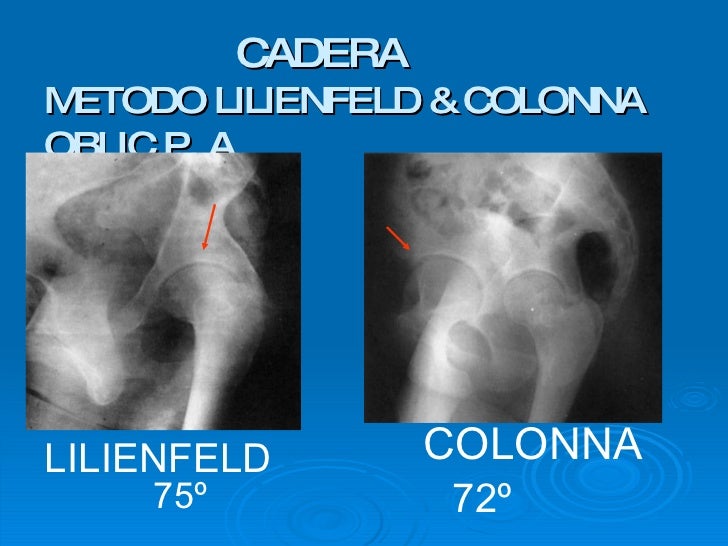 rx Pelvis.proyec.no convencionales-Lic.Juan Jose MOntico -Argentina.C…