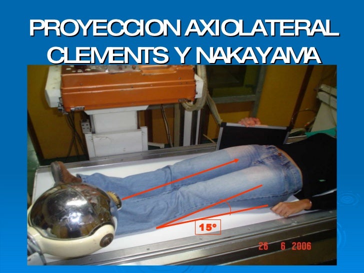 rx Pelvis.proyec.no convencionales-Lic.Juan Jose MOntico -Argentina.C…