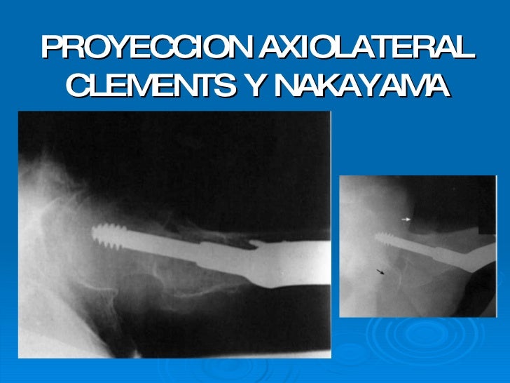 rx Pelvis.proyec.no convencionales-Lic.Juan Jose MOntico -Argentina.C…