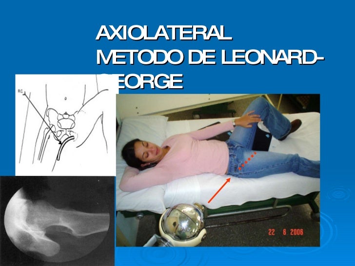 rx Pelvis.proyec.no convencionales-Lic.Juan Jose MOntico -Argentina.C…