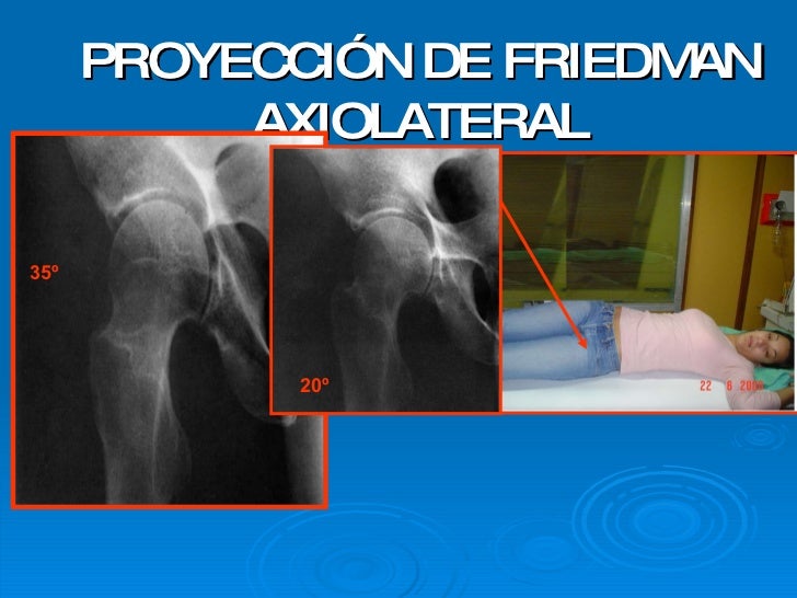 rx Pelvis.proyec.no convencionales-Lic.Juan Jose MOntico -Argentina.C…