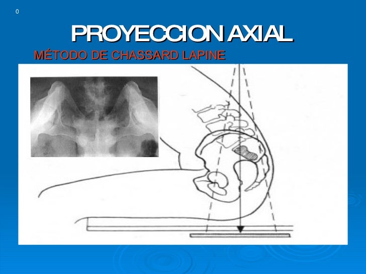 rx Pelvis.proyec.no convencionales-Lic.Juan Jose MOntico -Argentina.C…