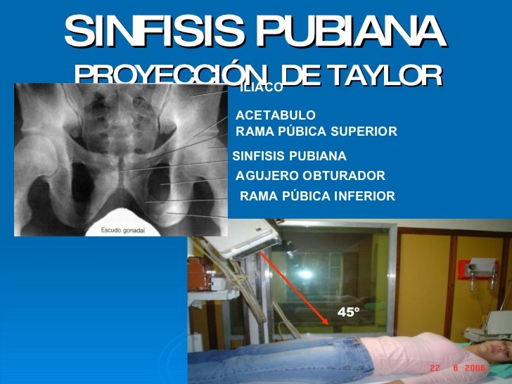 rx Pelvis.proyec.no convencionales-Lic.Juan Jose MOntico -Argentina.C…