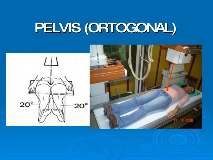 rx Pelvis.proyec.no convencionales-Lic.Juan Jose MOntico -Argentina.C…