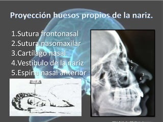 Proyecciones radiológicas del cráneo | PPTX