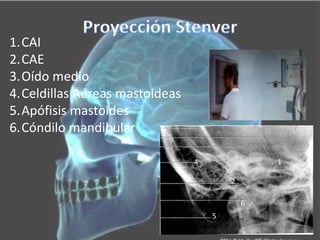 Proyecciones radiológicas del cráneo | PPTX