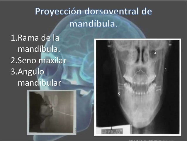 Proyecciones radiológicas del cráneo