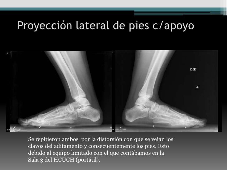 Proyecciones Radiológicas MMII