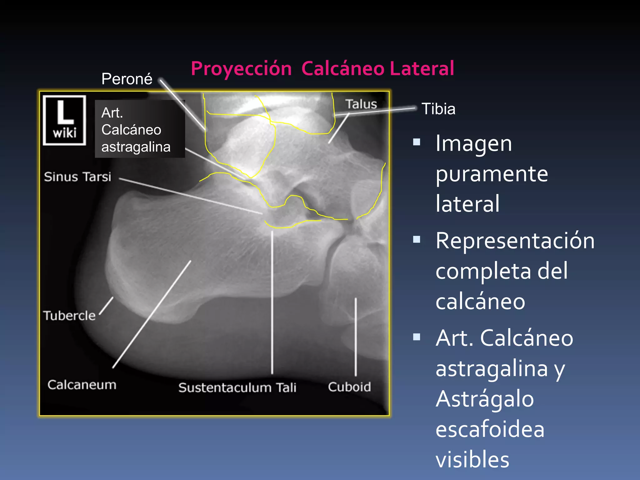 Proyecciones Radiologicas Miembro Inferior | PPT