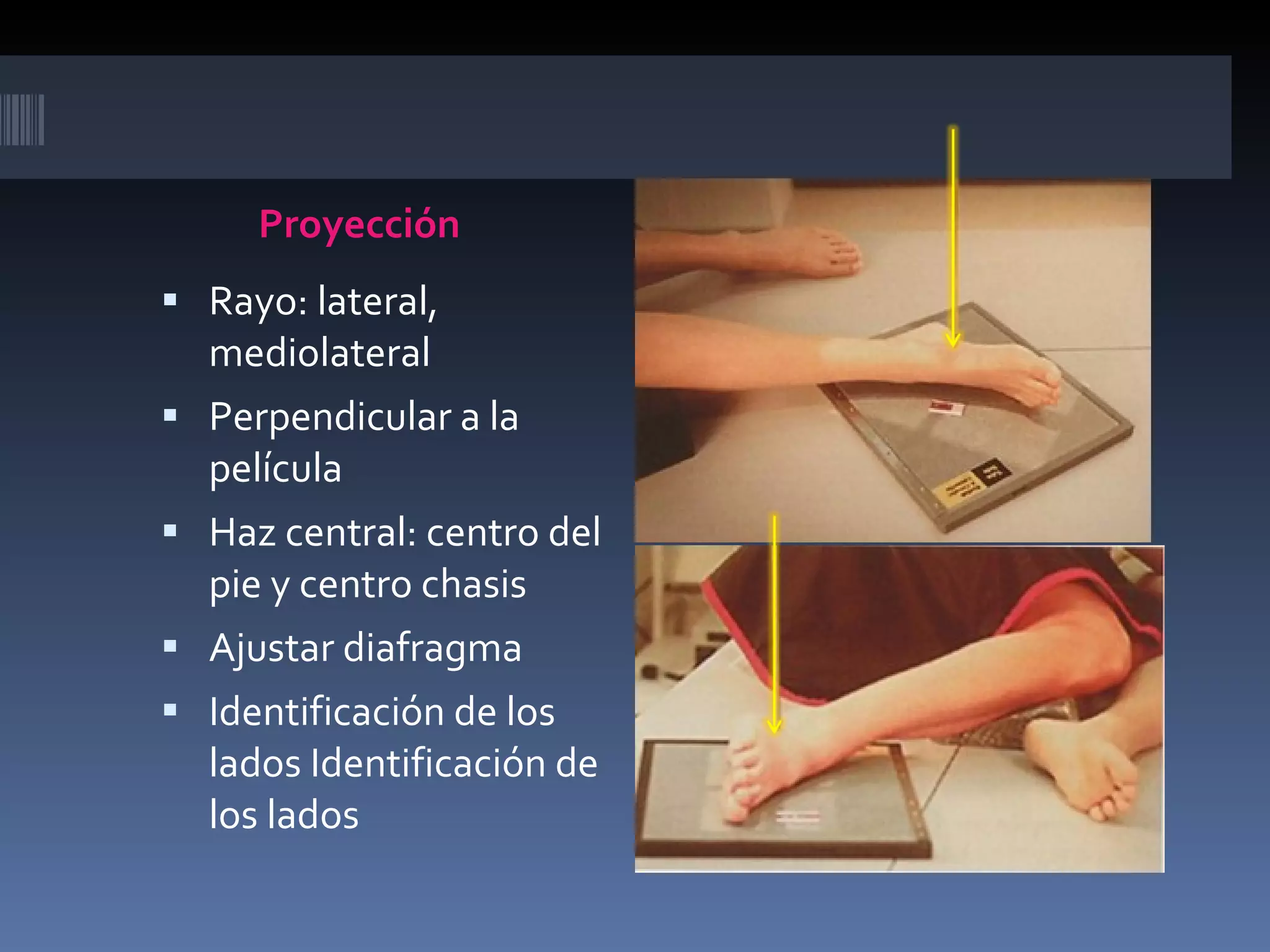 Proyecciones Radiologicas Miembro Inferior | PPT