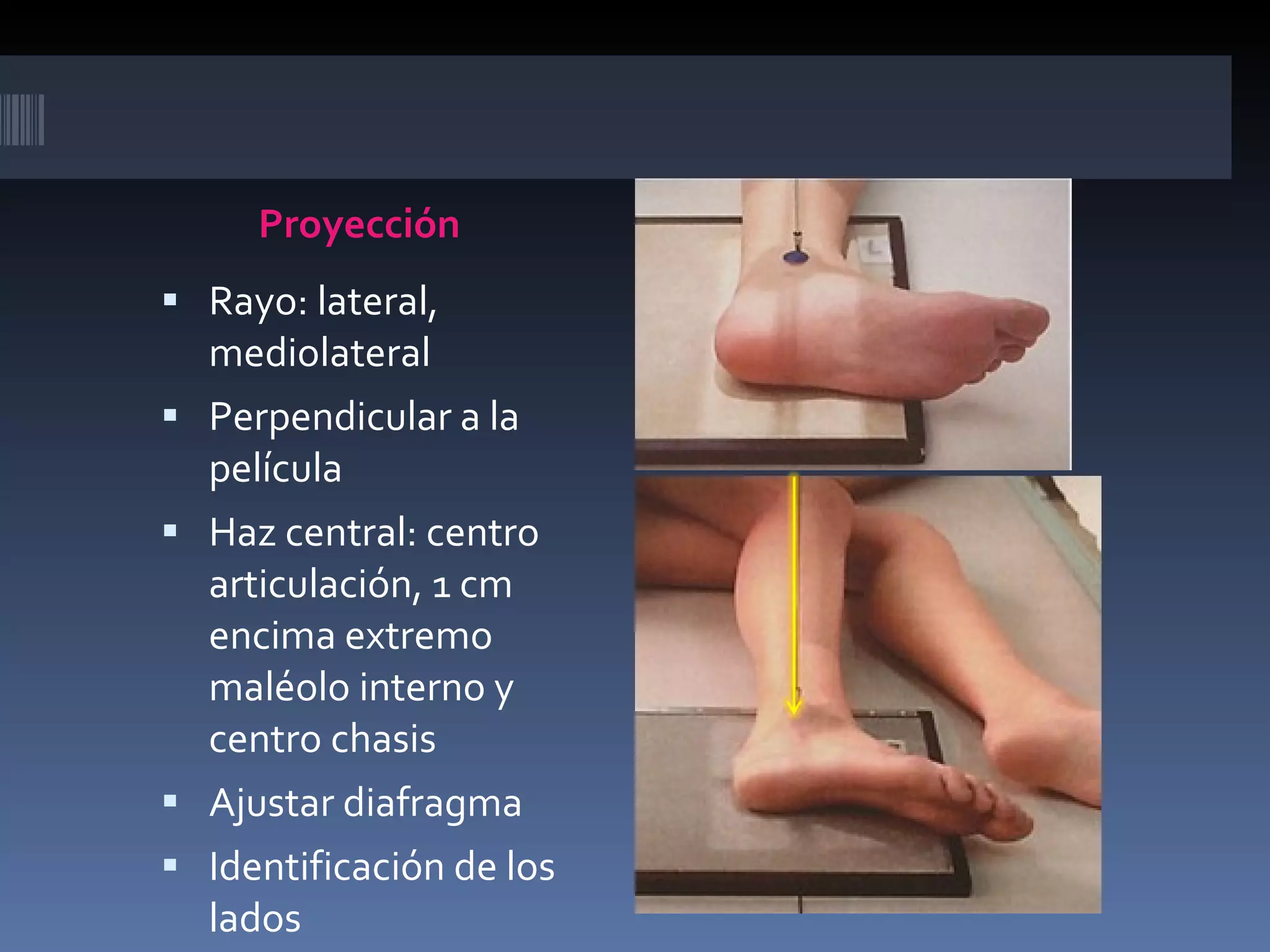 Proyecciones Radiologicas Miembro Inferior | PPT