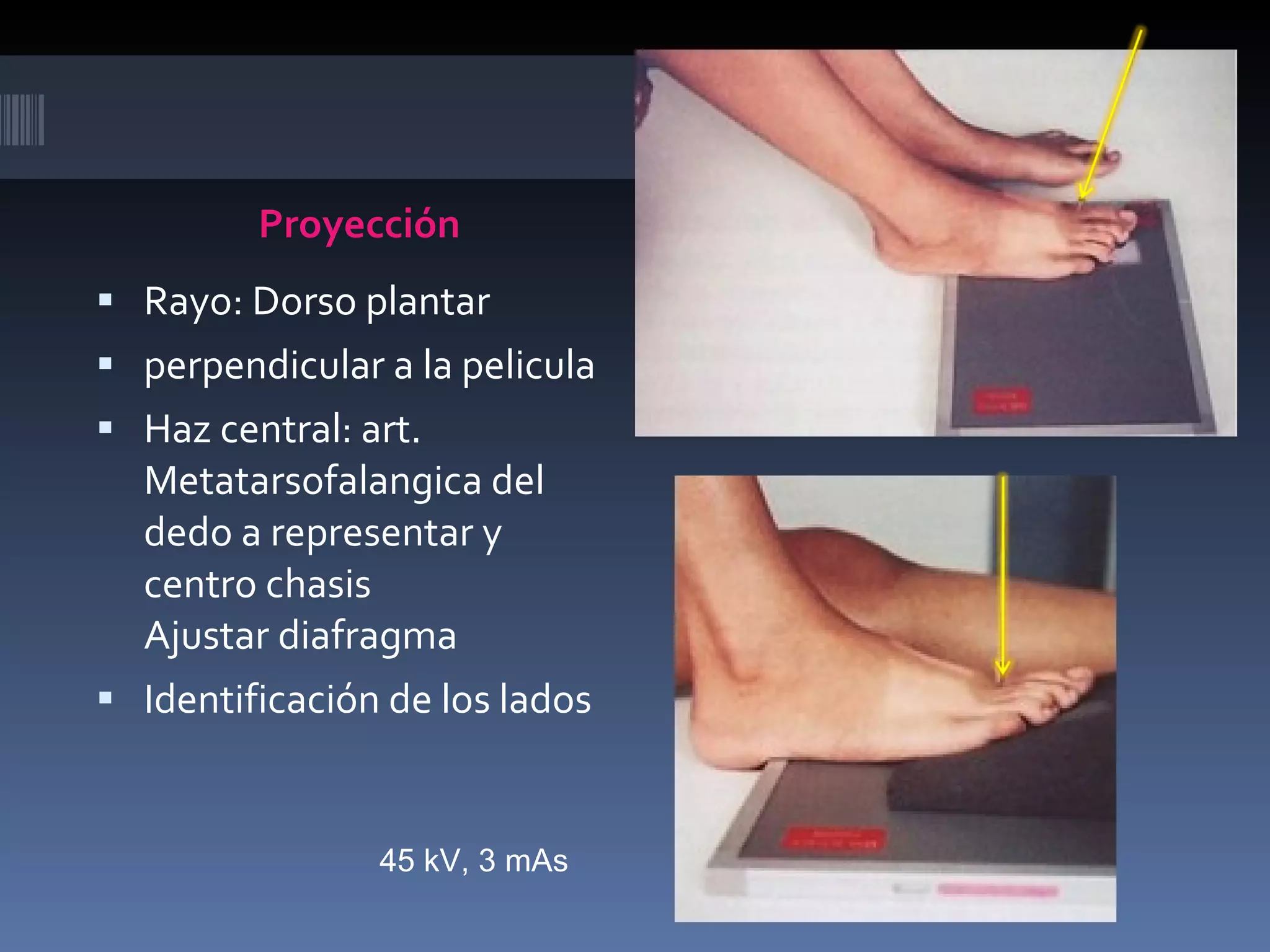 Proyecciones Radiologicas Miembro Inferior | PPT