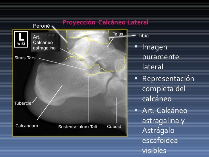 Proyecciones Radiologicas Miembro Inferior