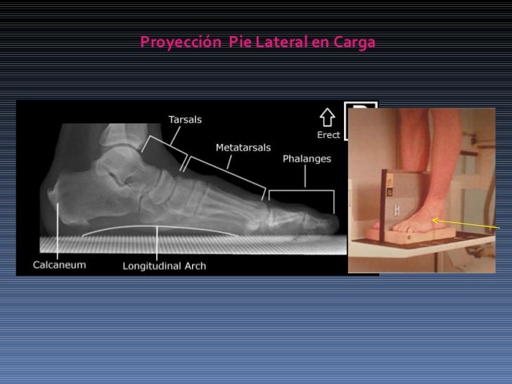 Proyecciones Radiologicas Miembro Inferior