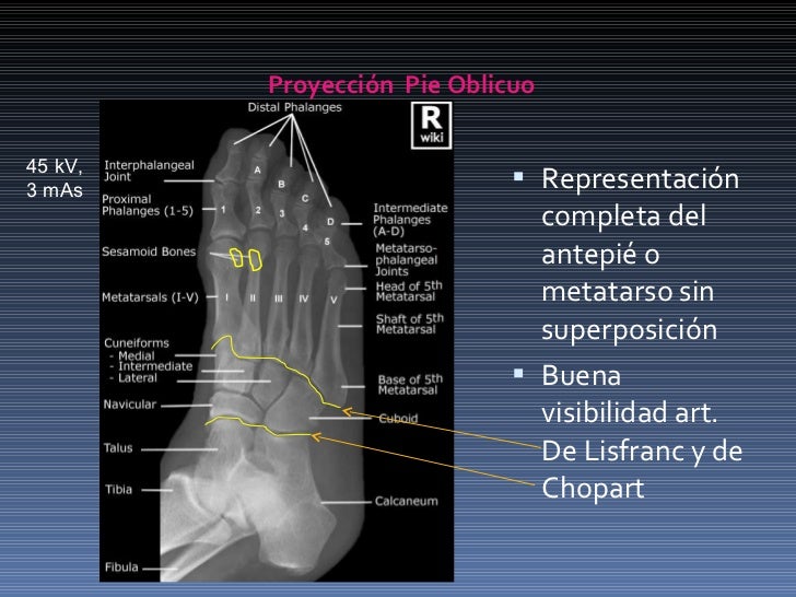 Proyecciones Radiologicas Miembro Inferior