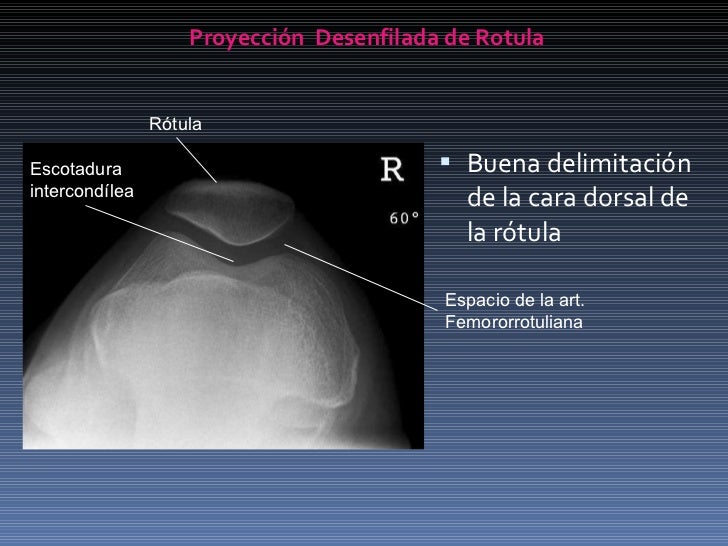 Proyecciones Radiologicas Miembro Inferior
