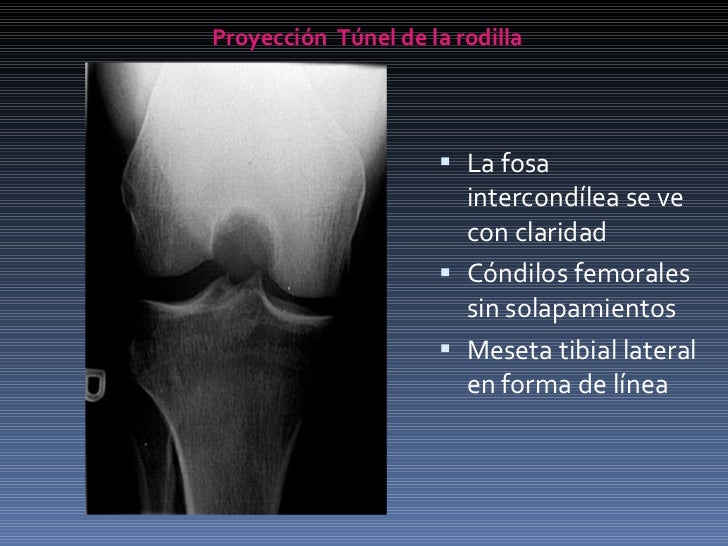 Proyecciones Radiologicas Miembro Inferior