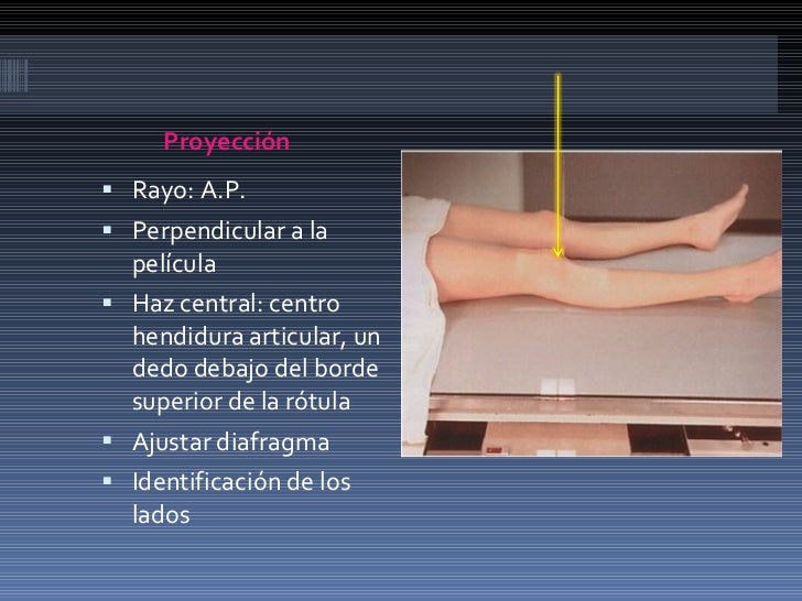 Proyecciones Radiologicas Miembro Inferior