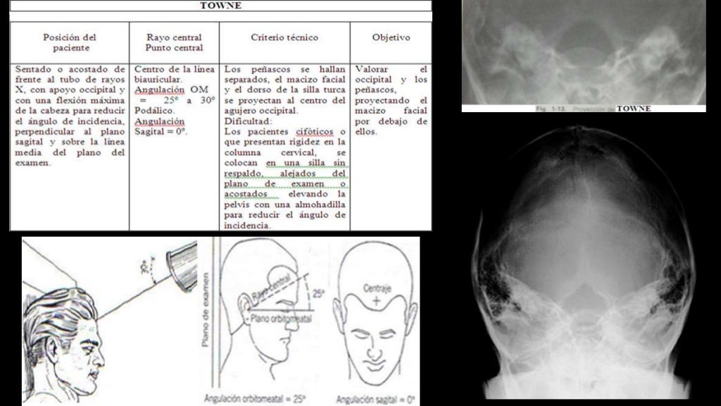 PROYECCIONES RADIOGRÁFICAS DE CRANEO