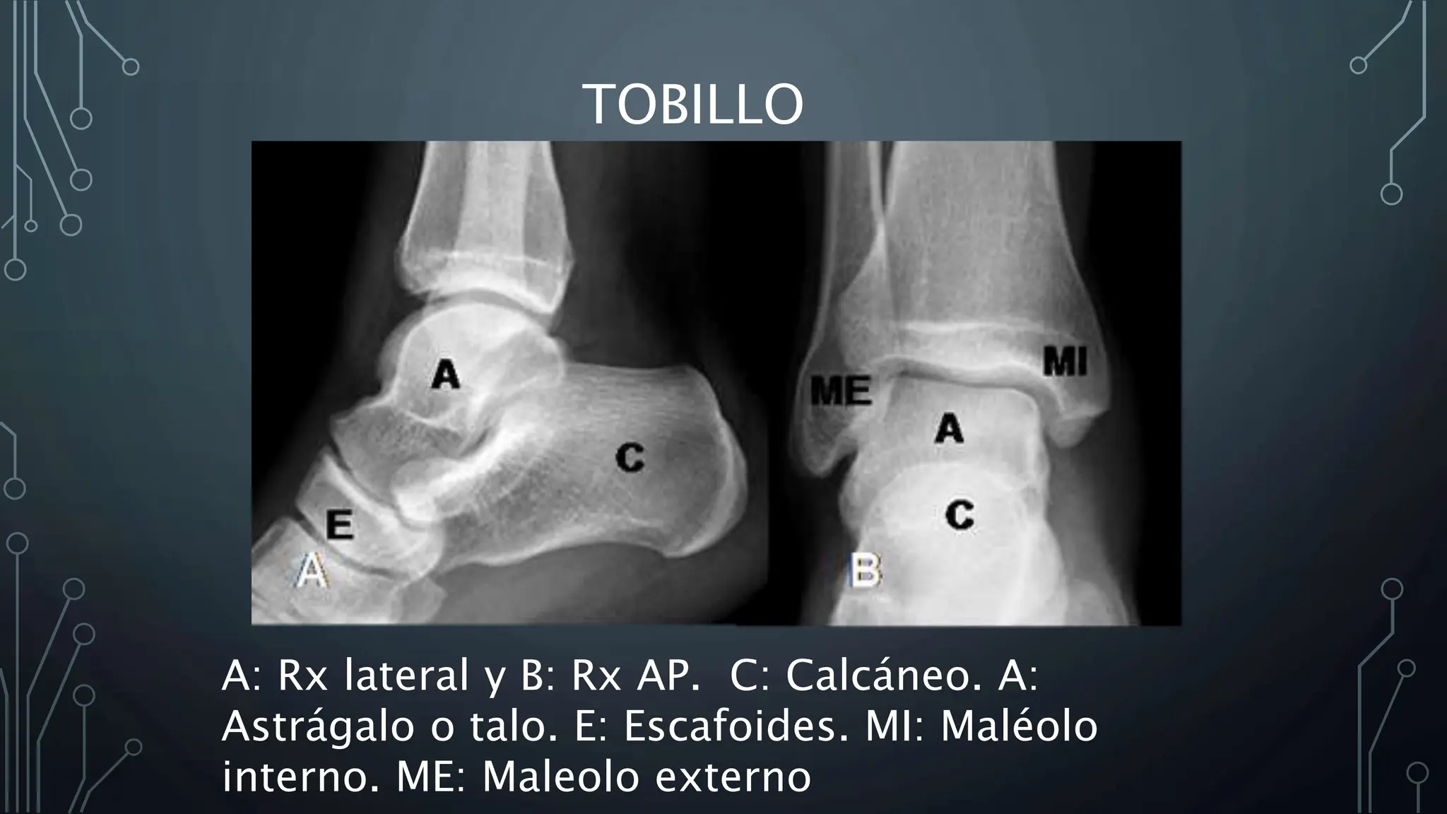 PROYECCIONES RADIOLOGICAS EN EXTREMIDADES INFERIORES.pptx