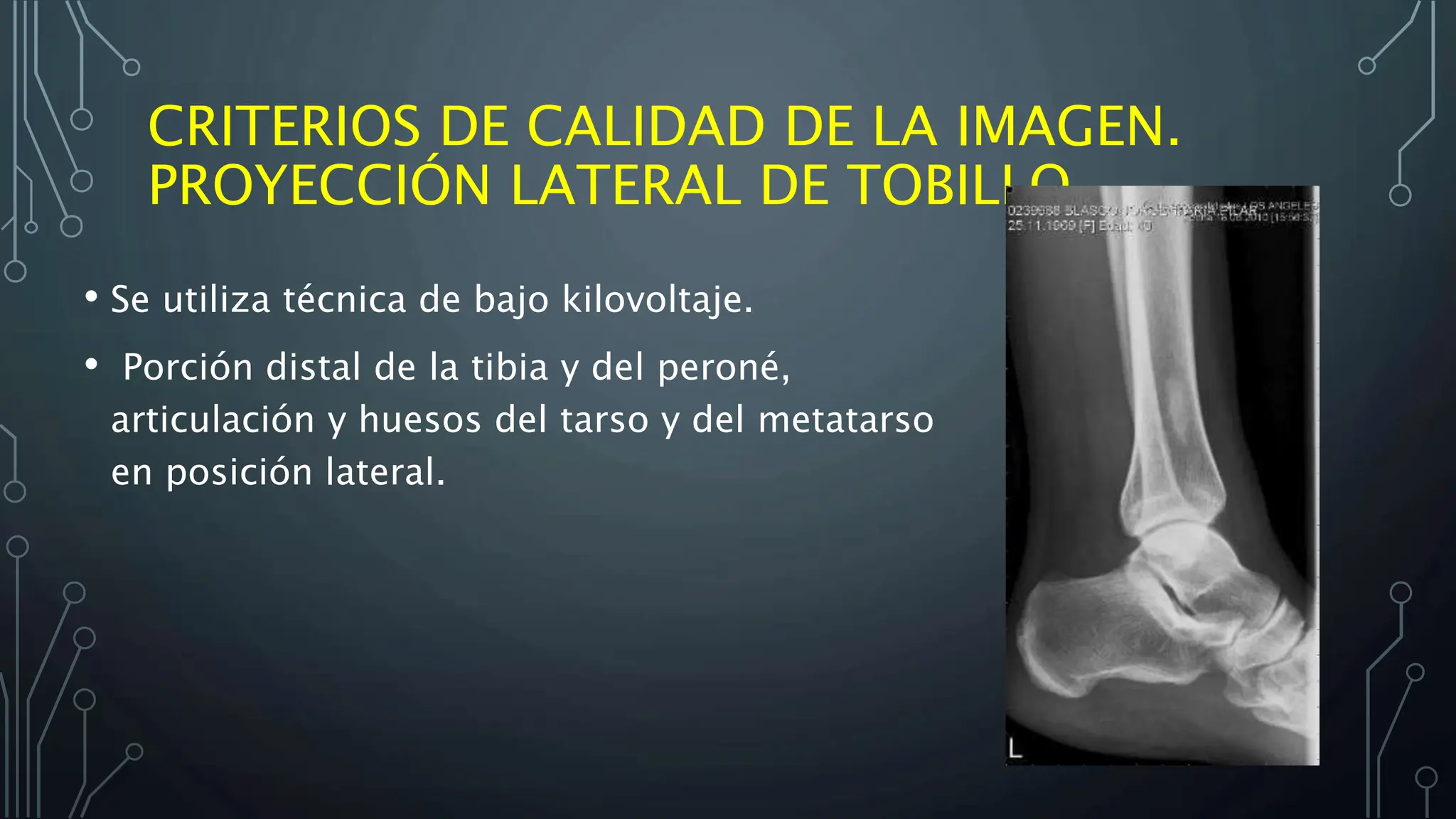 PROYECCIONES RADIOLOGICAS EN EXTREMIDADES INFERIORES.pptx