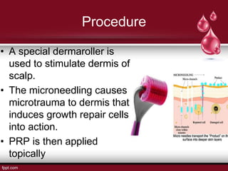 platelet rich plasma | PPTX