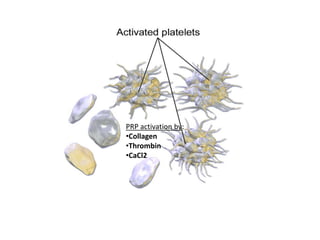 Platelet-Rich-Plasma | PDF