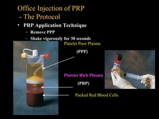 Plasma Rich Platelets use in Medicine | PPT | Death, Injury, or ...
