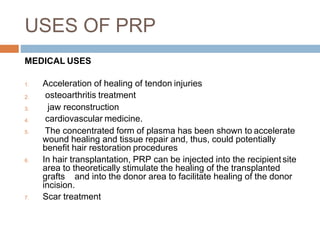 Prp hair-loss-treatment | PPTX