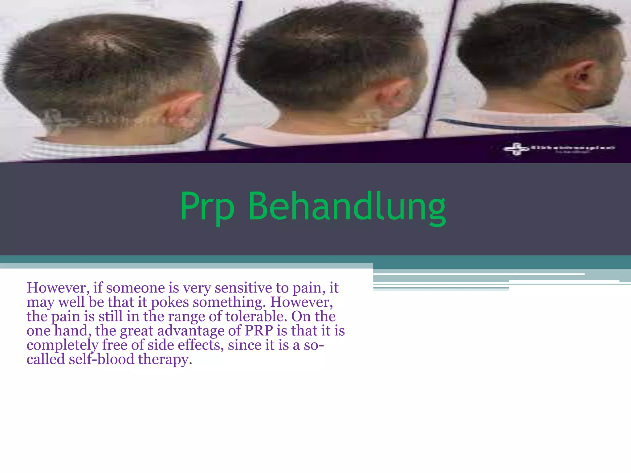 Prp behandlung | PPT