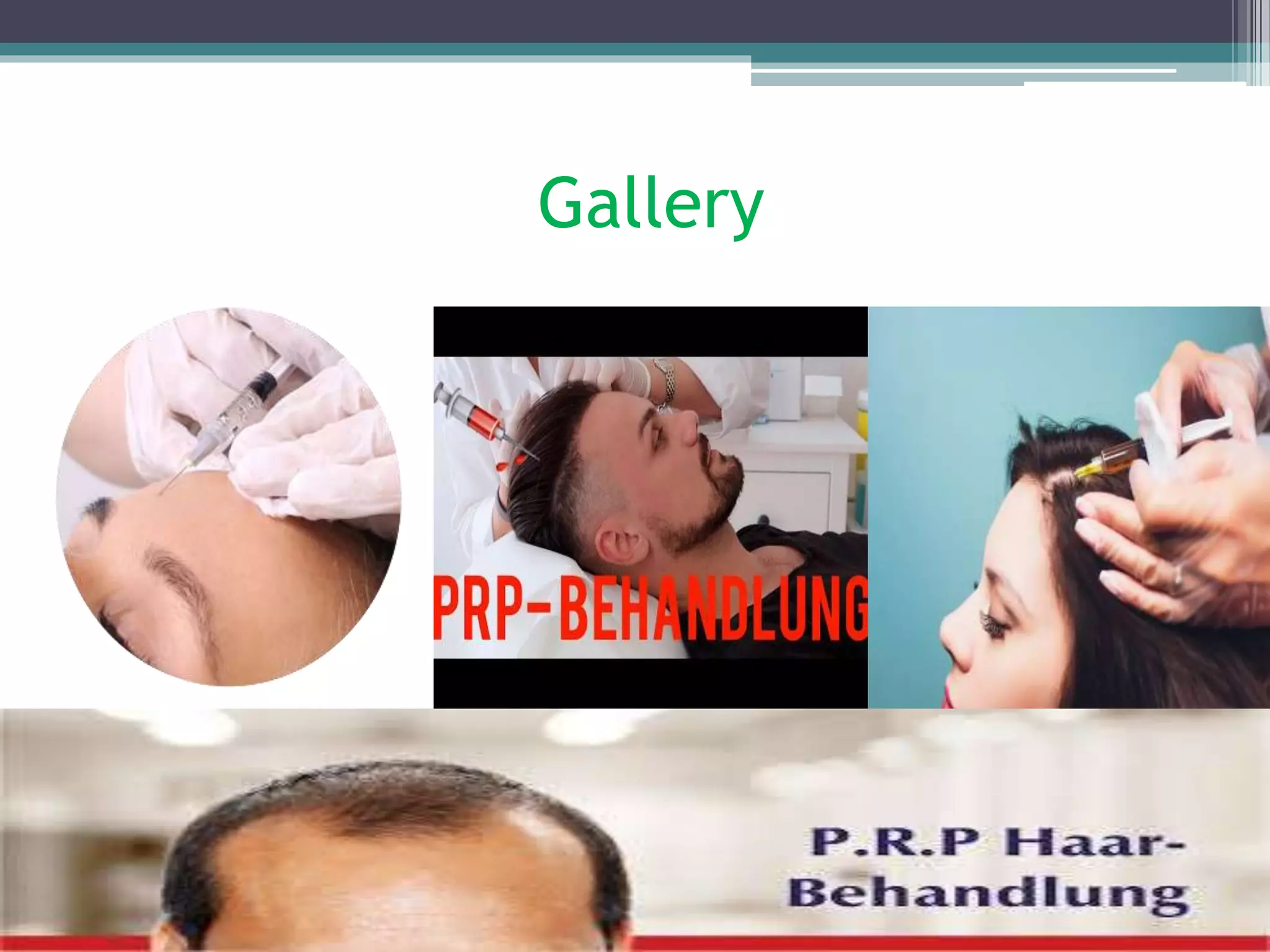Prp behandlung | PPT