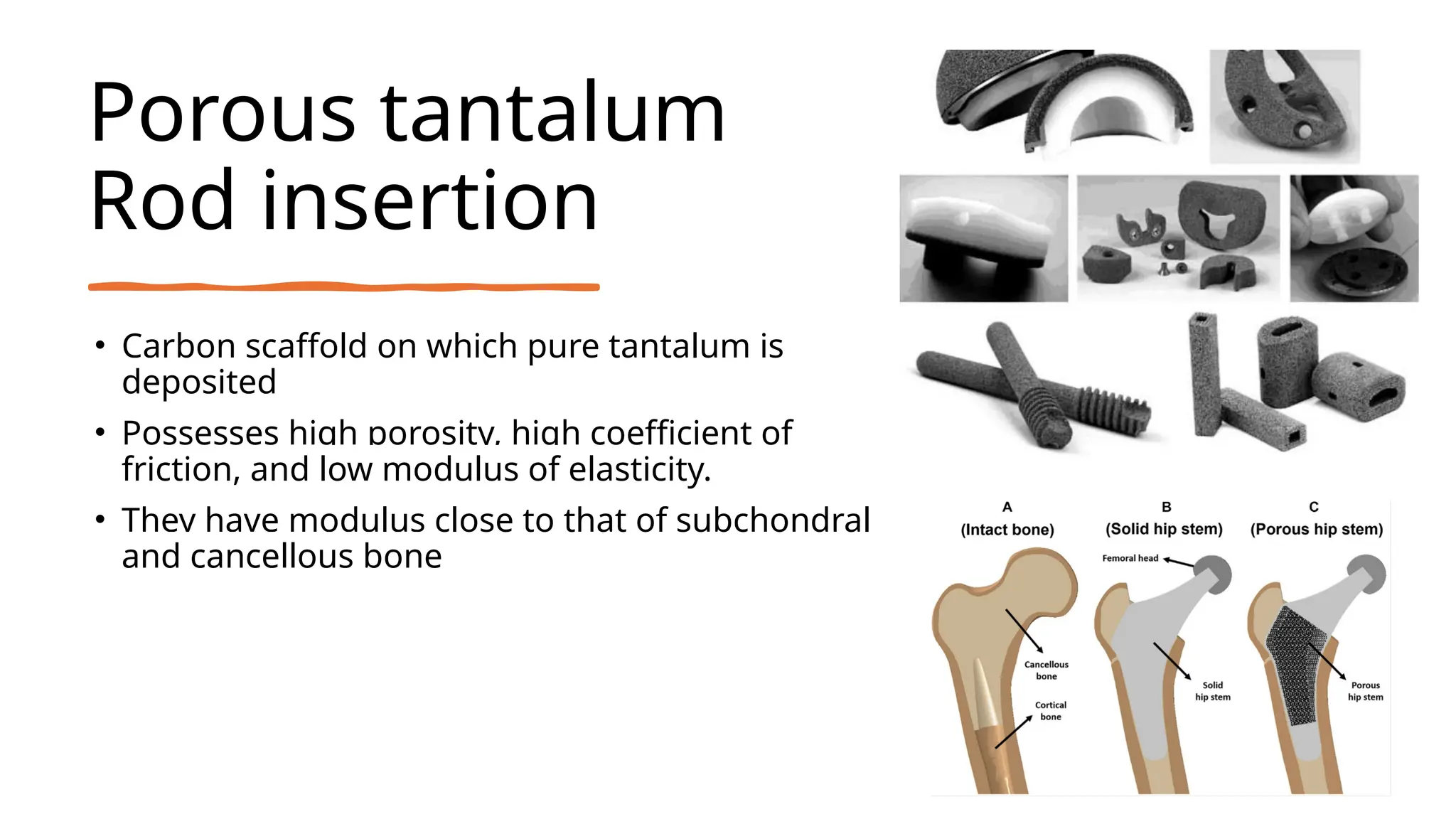 PRP & Bioinert materials in orthopaedics .pptx | Blood Disorders ...