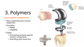 PRP & Bioinert materials in orthopaedics .pptx