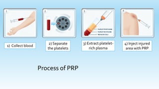 PRP for Chronic Pain | PDF