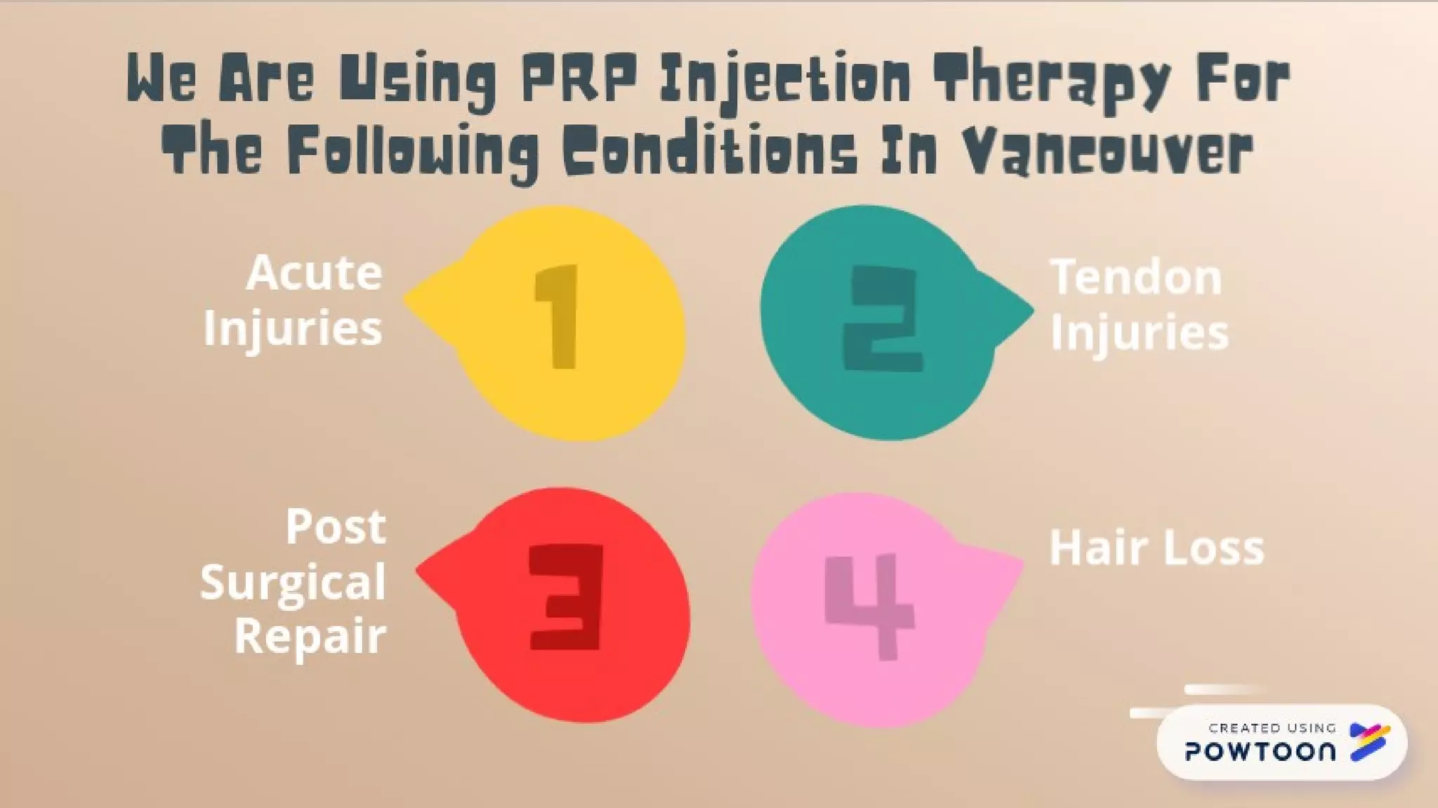 Prp injection | PPT