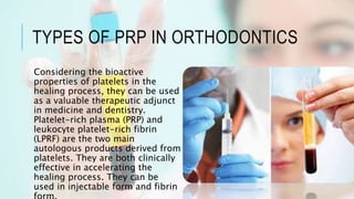 PRP in Orthodontics | PPTX