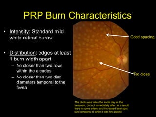 PRP ISIS Lecture.ppt