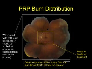 PRP ISIS Lecture.ppt